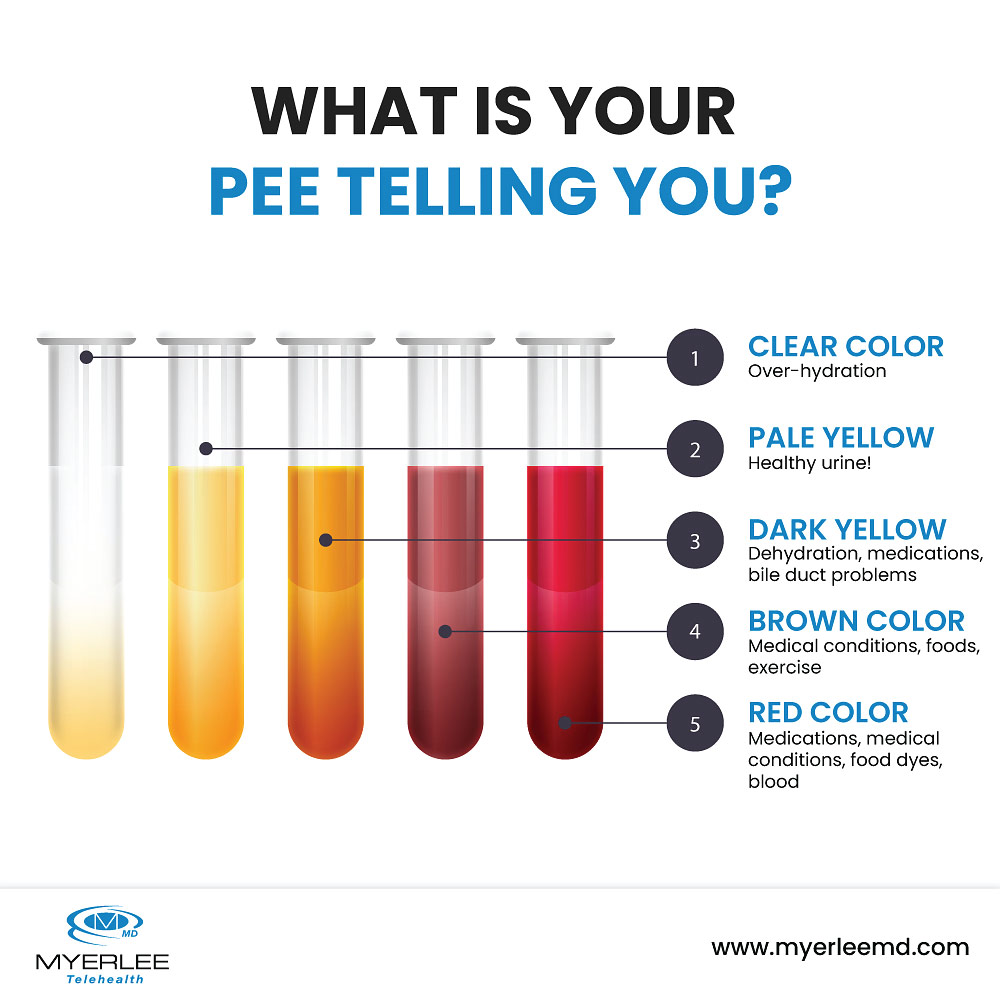 What to Know About Urinary Tract Infection | MyerleeMD